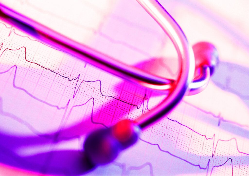 What Blood Pressure Spikes Mean and How to Manage Them